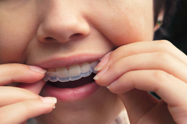 The Dangers of Untreated Misaligned Teeth: Why Orthodontic Treatment ...